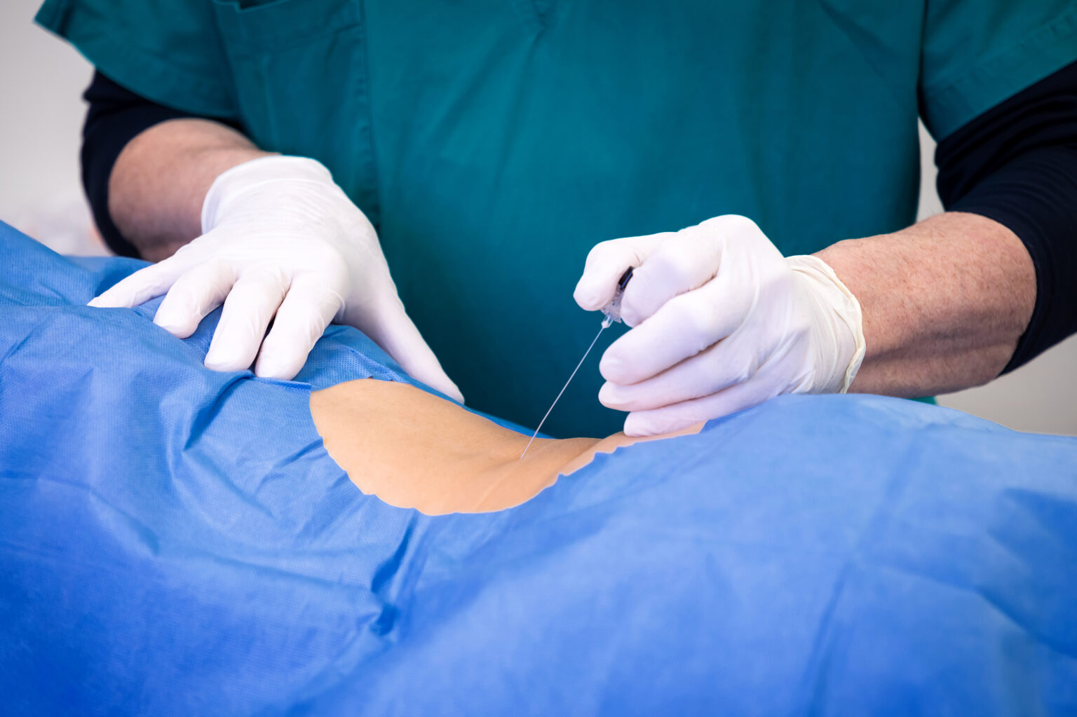Post Stroke Treatment With Stem Cell