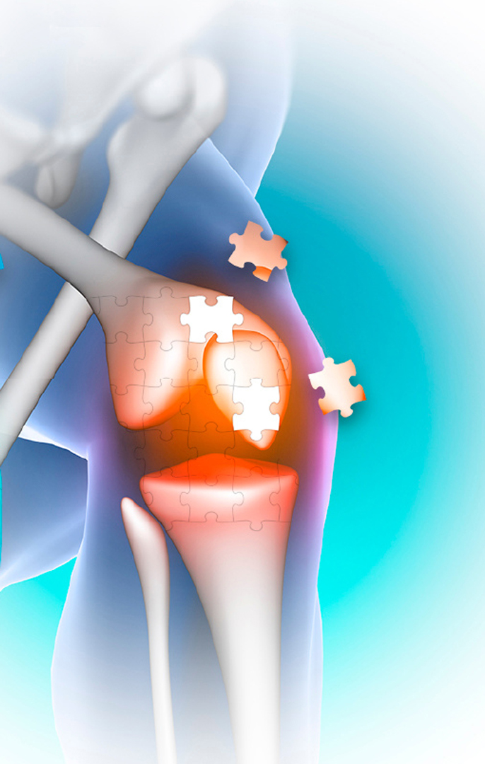 Stem Cell Joint Therapy | Stem Cell Joint injections| CRC